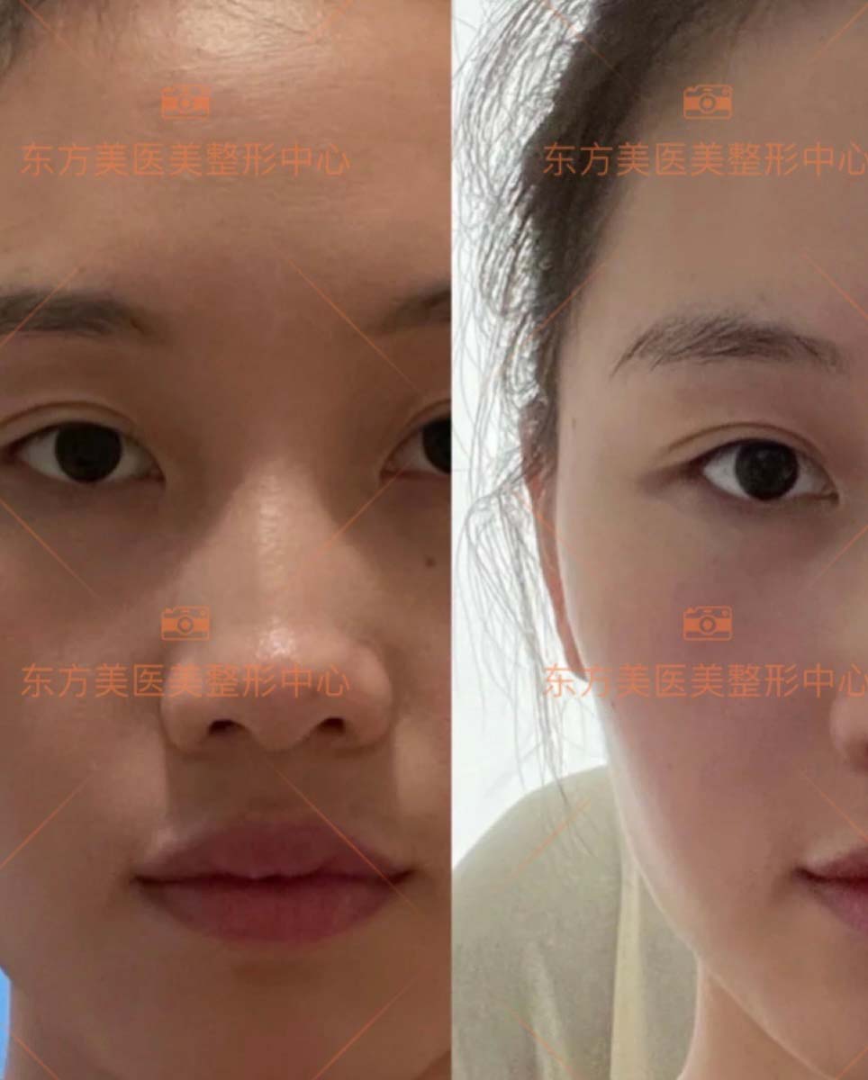 Before and After Cosmetic Gynecology Gallery - Dolores Kent